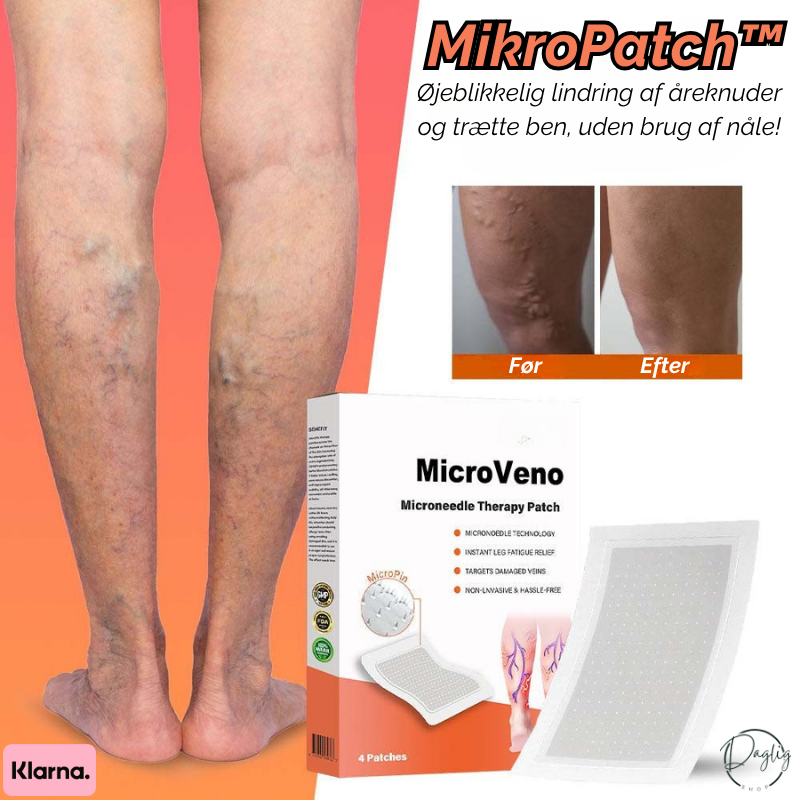 MikroPatch™ | Øjeblikkelig lindring af åreknuder og trætte ben, uden b ...